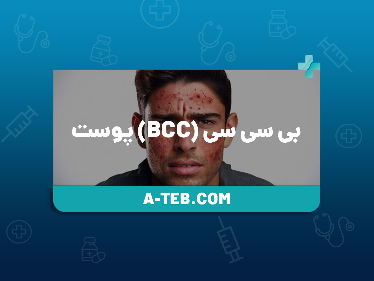 بی سی سی (BCC) پوست | علت، علائم، تشخیص، پیشگیری و درمان در منزل - آرین طب